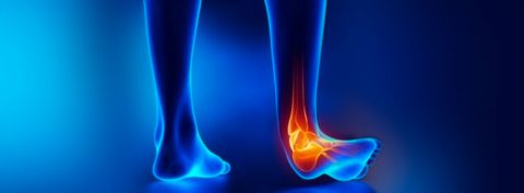ESGUINCE DE TOBILLO - Dr. Esteban Castro - Ortopedia y traumatología