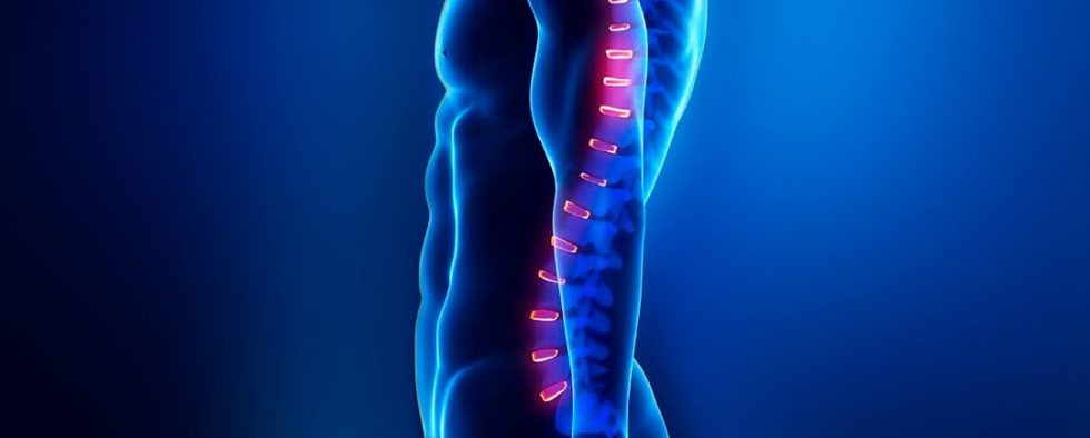 La Discectomía - Dr. Esteban Castro - Ortopedia y traumatología