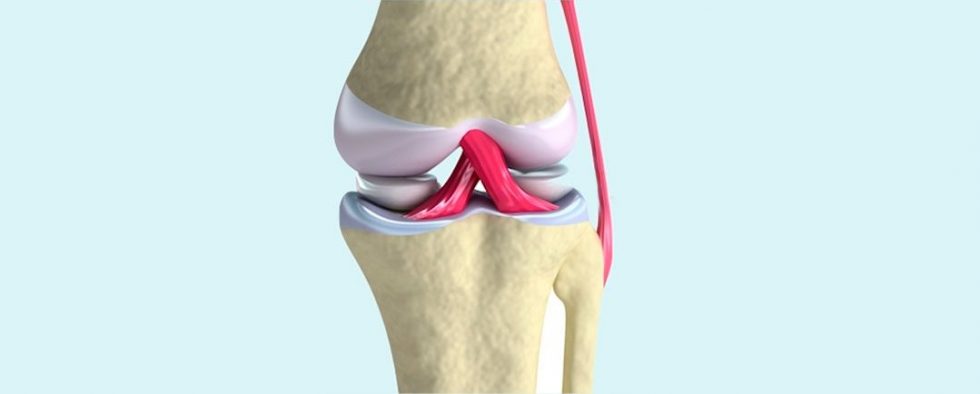 Menisco Rasgado - Dr. Esteban Castro - Ortopedia y traumatología